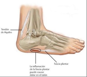espolon | TUSALUDESVIDA